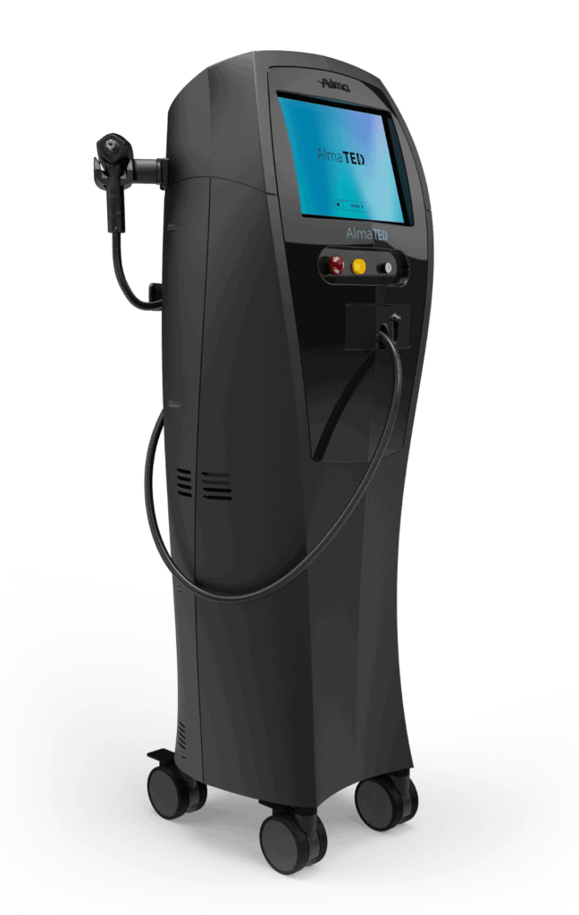 Alma TED Hair Restoration | AdvancedMD Aesthetics